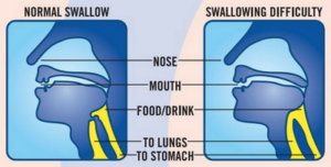 Swallowing | Lear Communication